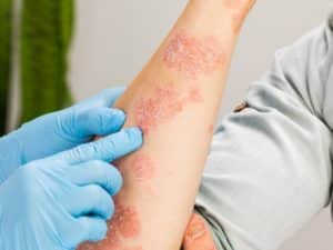 How can you tell if a skin rash is serious? - Westchester Dermatology ...